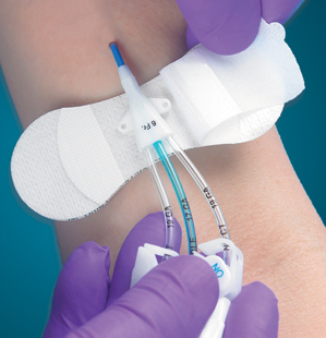 Grip-Lok PICC/CVC Securement Device Sterile Medium MedCompPro-PICC 50/box